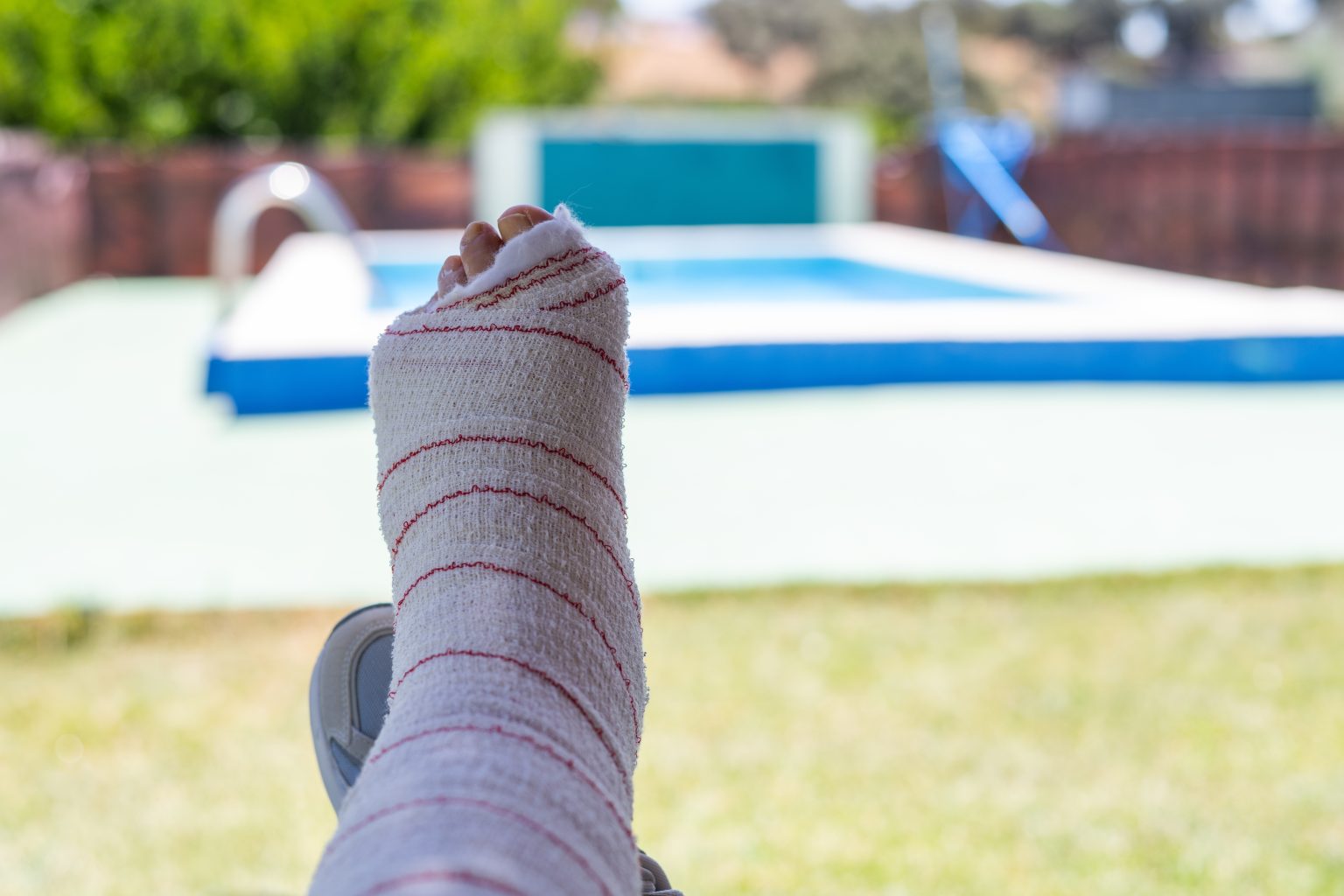 Can You Go Swimming with a Cast?